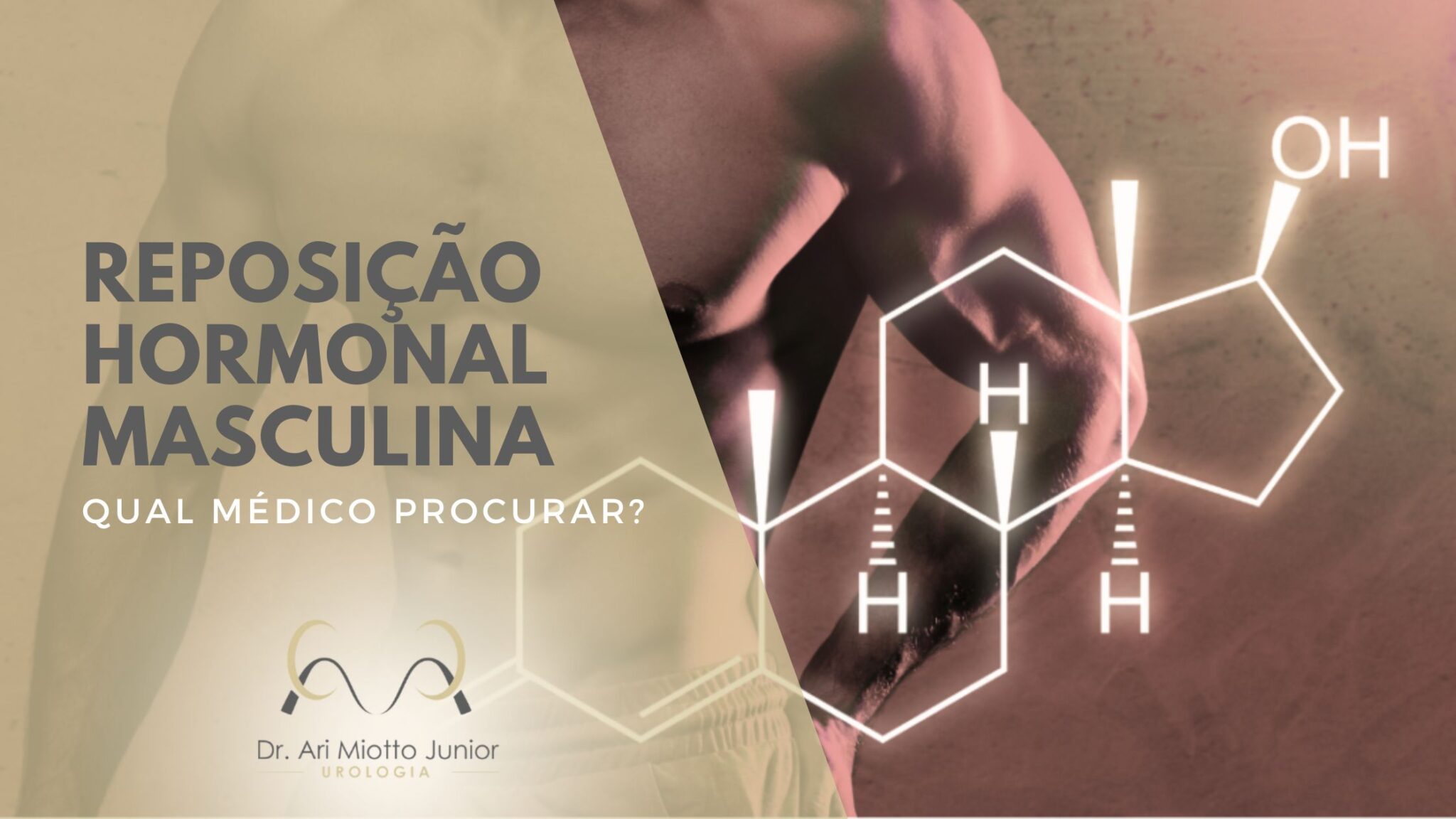 Reposição Hormonal Masculina Qual Médico Procurar Urologista Em